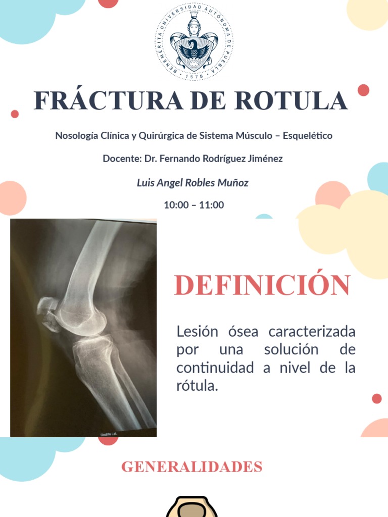 Fractura de Rótula: Clasificación y Tratamiento | PDF | Rodilla ...