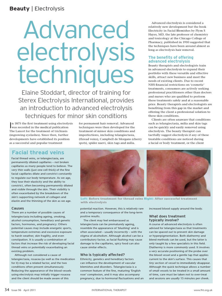 Advanced Electrolysis Techniques | PDF | Medicine | Clinical Medicine
