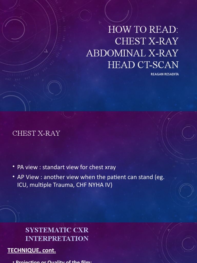 How To Read Chest Abdomen CT Scan X-Ray | PDF | Large Intestine ...