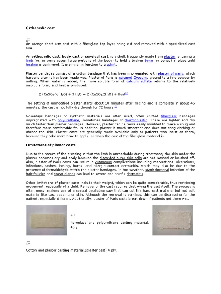 Orthopedic cast | Musculoskeletal System | Injury