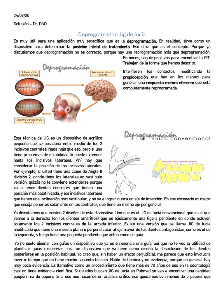 Jig de Lucía 24 Sept | PDF | Pintura acrilica | Boca