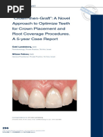 The Inverse injection layering technique | PDF | Dental Composite ...