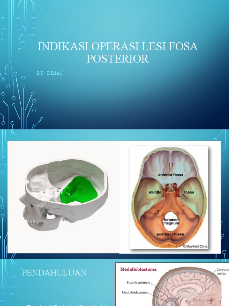 Fosa Posterior Lesion | PDF