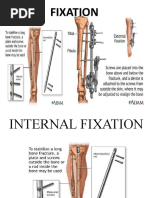 Below Knee Slab Techniques in Ortho | PDF