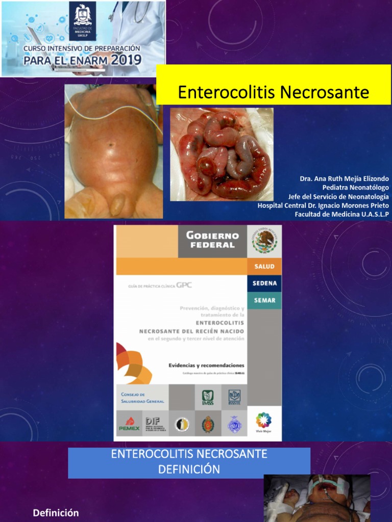 Enterocolitis Necrosante en Neonatos | PDF | Diarrea | Gastroenterología
