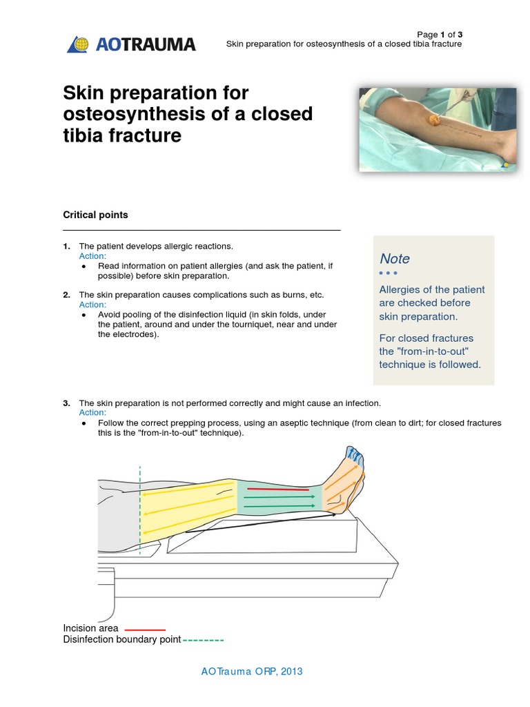 Skin Preparation For Osteosynthesis of A Closed Tibia Fracture | PDF ...
