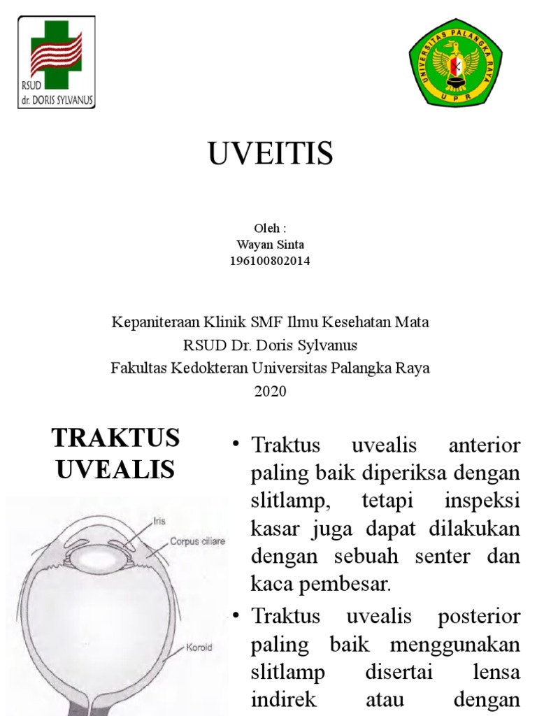 UVEITIS | PDF