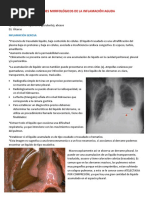 Exudado Seroso PATOLOGIA | PDF | Inflamación | Edema