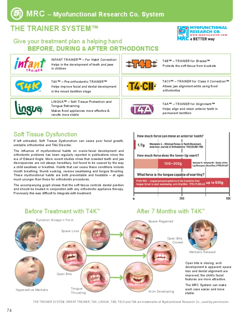 The Trainer System™: Before, During After Orthodontics | PDF ...