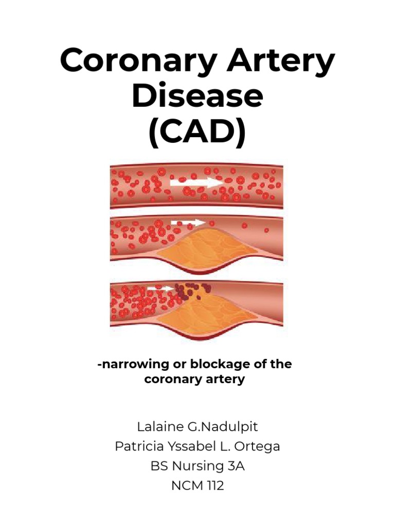 CAD Concept Map Final | PDF