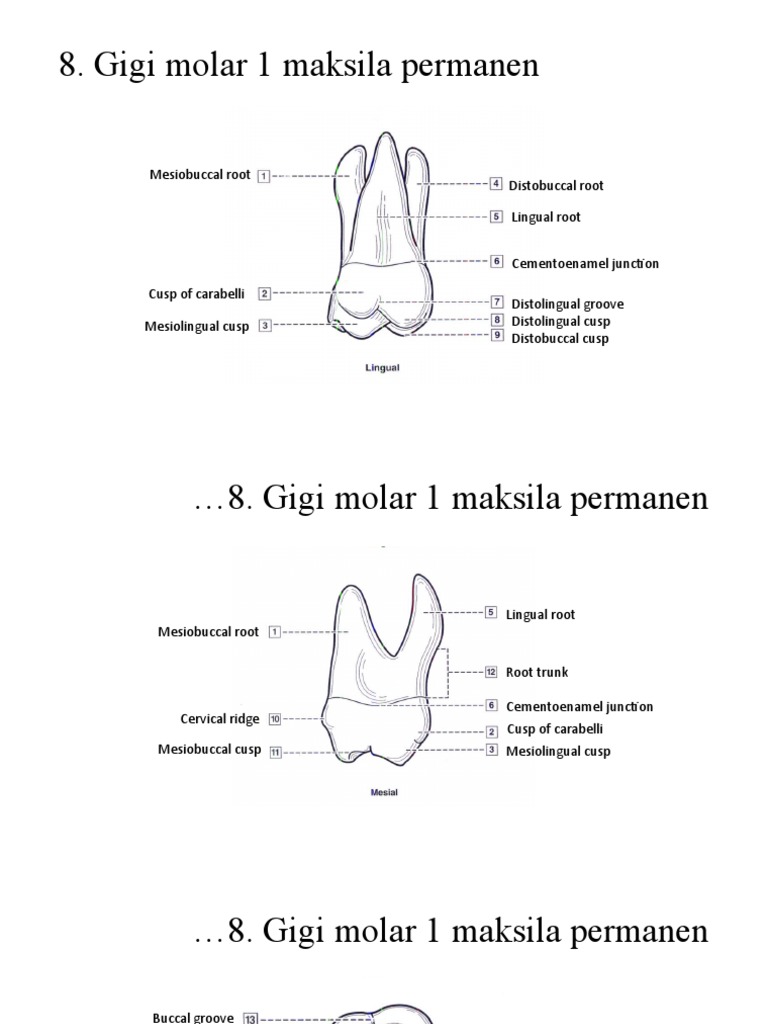 Gigi Molar 1 Maksila Permanen: Mesiobuccal Root Distobuccal Root ...
