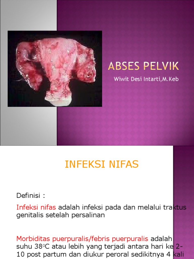 Abses Pelvis pada Ibu Nifas | PDF | Sains & Matematika