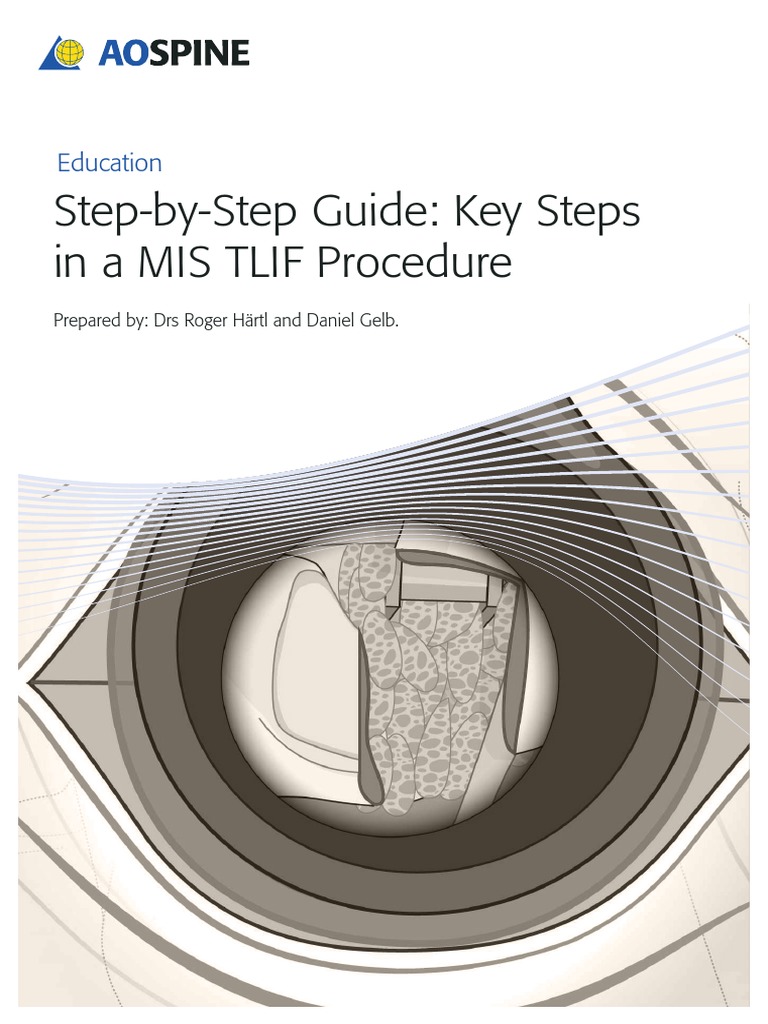 Step-by-Step Guide - Key Steps in A MIS TLIF Procedure PDF | PDF ...
