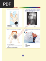 Blantyre Coma Scale for Children | PDF | Coma | Medicine