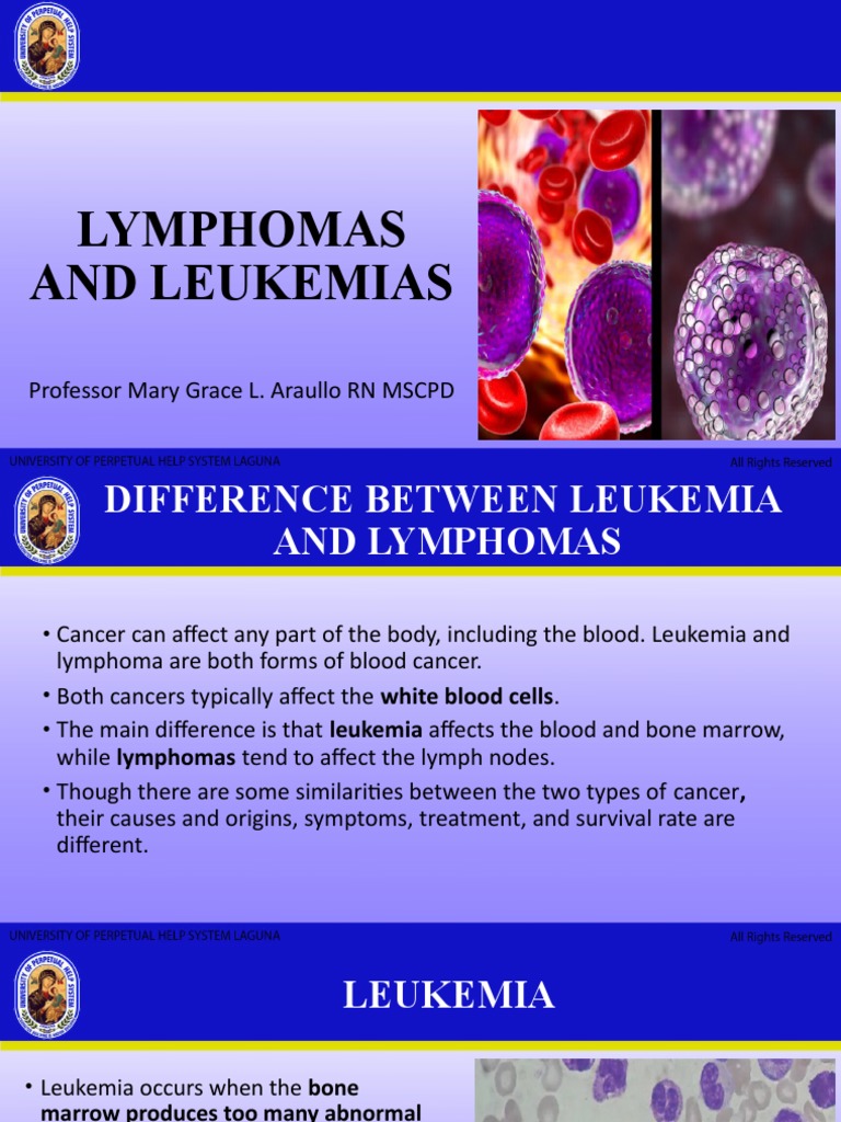 Leukemia vs Lymphoma: Key Differences | PDF | Lymphoma | Leukemia