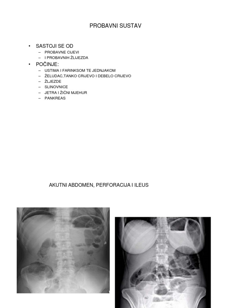 Probavni Sustav - v1 PDF | PDF