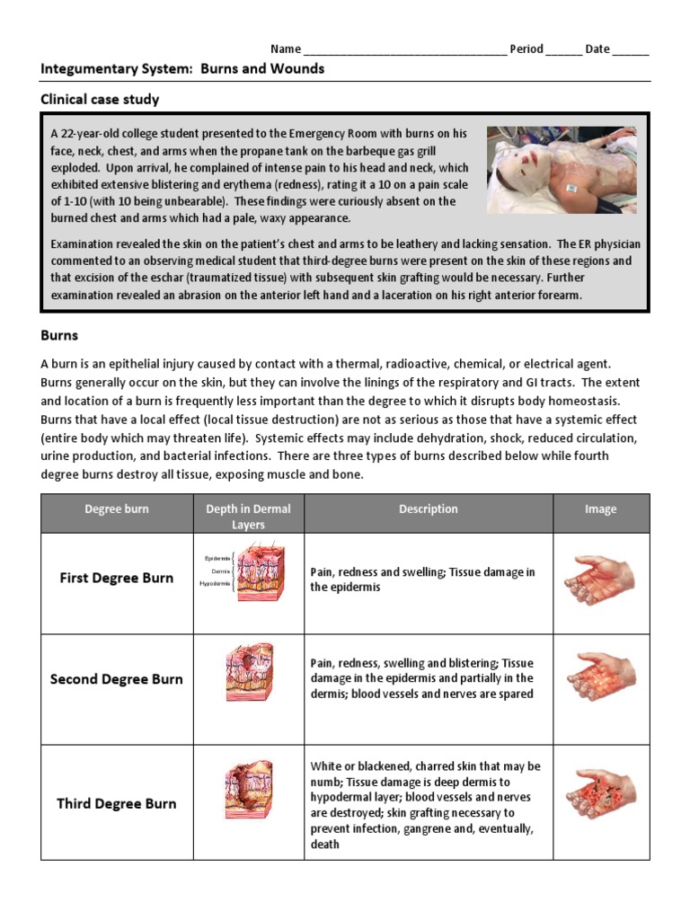 Burns and Wounds Lab | PDF | Wound Healing | Burn