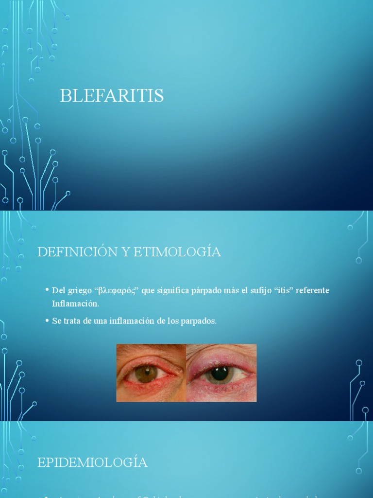Blefaritis Presentación | PDF | Ciencias de la Salud | Medicina