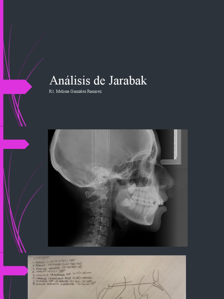 Análisis de Jarabak | PDF