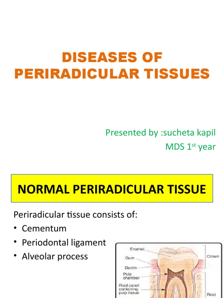 Periradicular Diseases Overview | PDF | Human Tooth | Periodontology