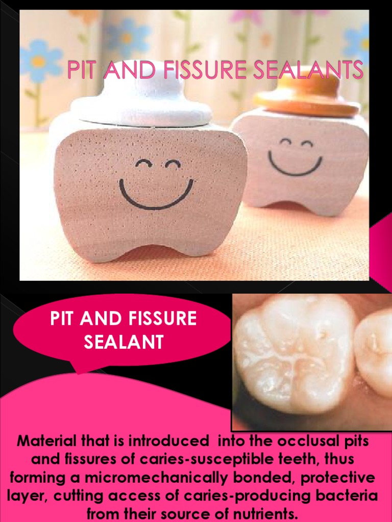 Final Prof Lecture On Pit and Fissure Sealant PDF | PDF | Tooth Enamel ...