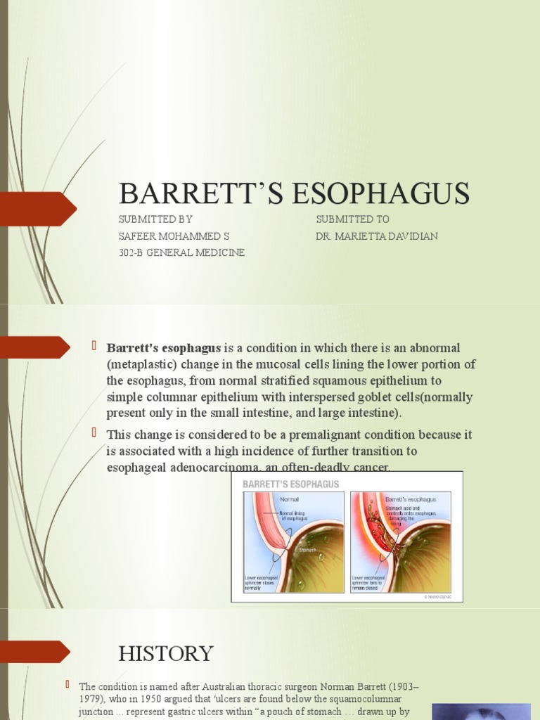 Propedeutics - Barrett's Esophagus - SMS | PDF | Gastroenterology ...