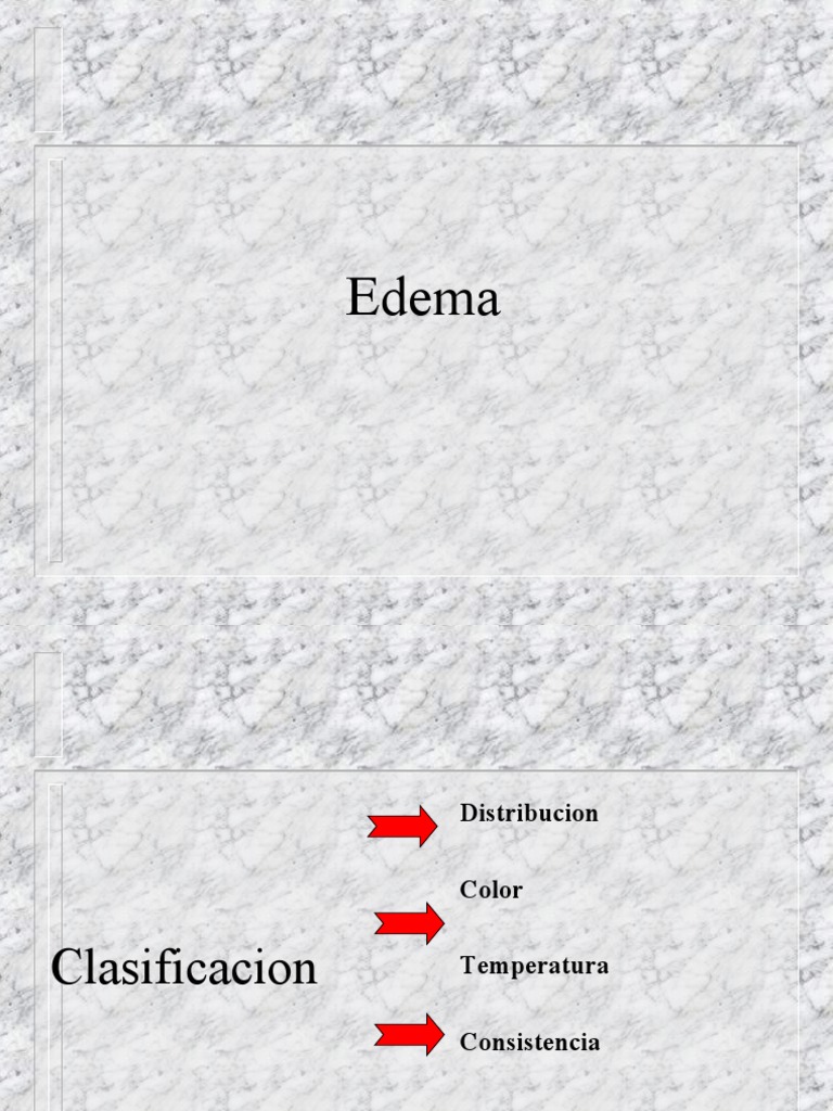 Clasificacion Edemas | PDF | Edema | Enfermedades cardiovasculares