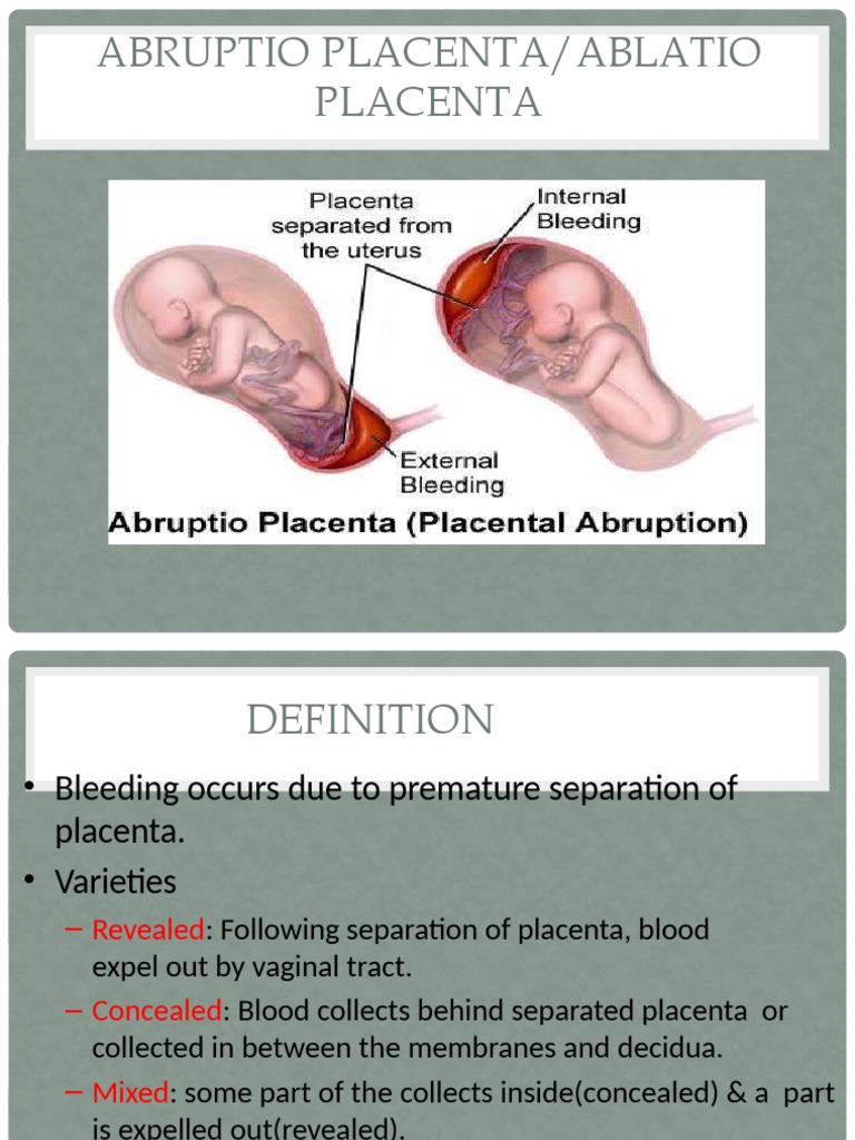 Placenta Previa Vs Abruptio