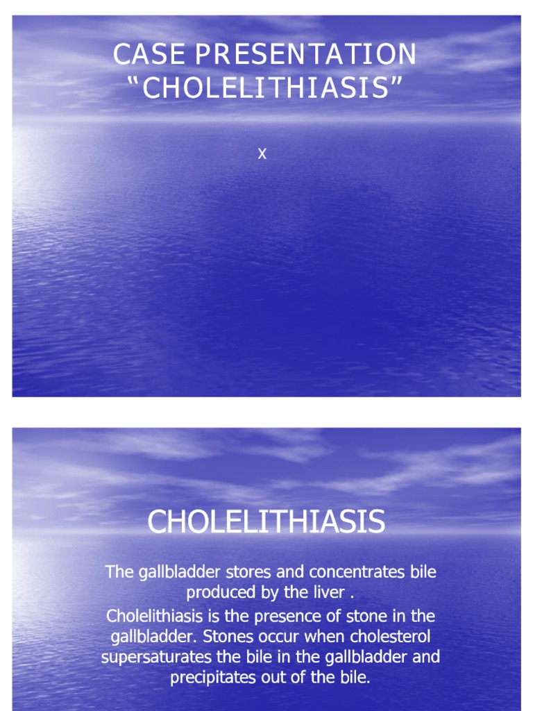 Cholelithiasis CS | PDF