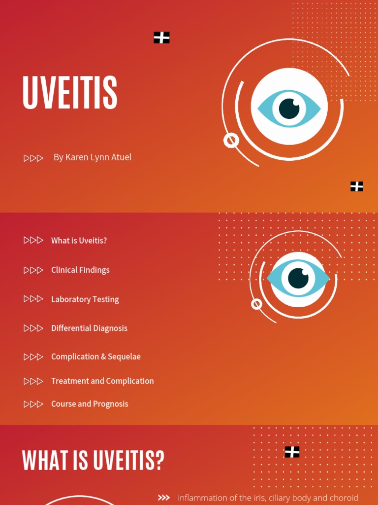 A Comprehensive Review of Uveitis: Etiology, Clinical Presentation ...