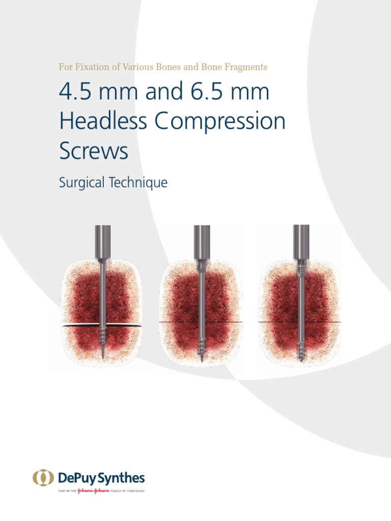4.5 MM and 6.5 MM Headless Compression Screws: Surgical Technique | PDF ...