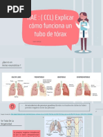 Guía para colocación de tubo de tórax | PDF | Tórax (anatomía humana ...