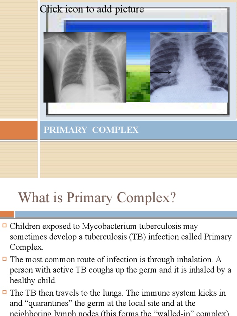Primary Complex | PDF | Tuberculosis | Infection