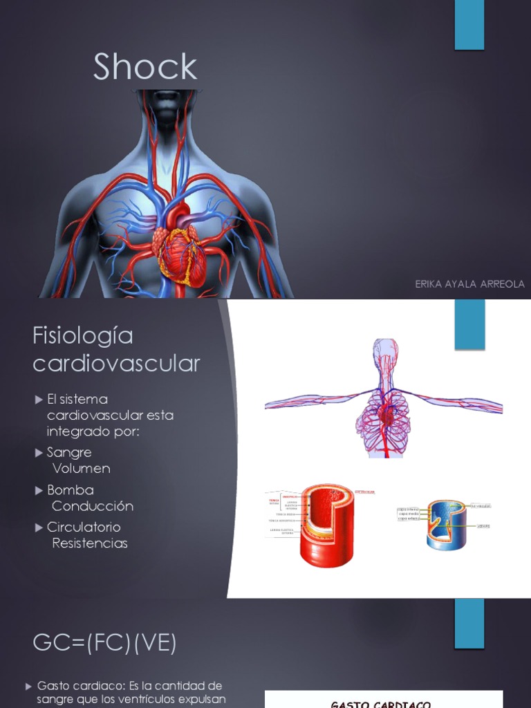 Fisiopatología del Shock Obstructivo | PDF | Corazón | Septicemia