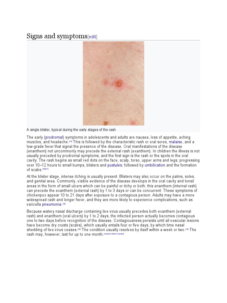 Signs and Symptoms: Prodromal Malaise | PDF