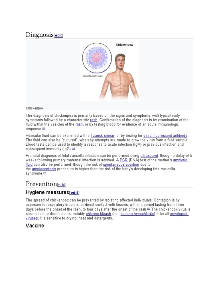 Chickenpox Diagnosis and Prevention Guide | PDF | Science & Mathematics