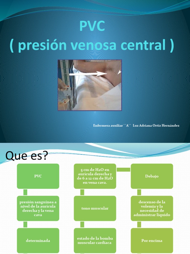 PVC (Presión Venosa Central) : Enfermera Auxiliar ''A'' Luz Adriana ...