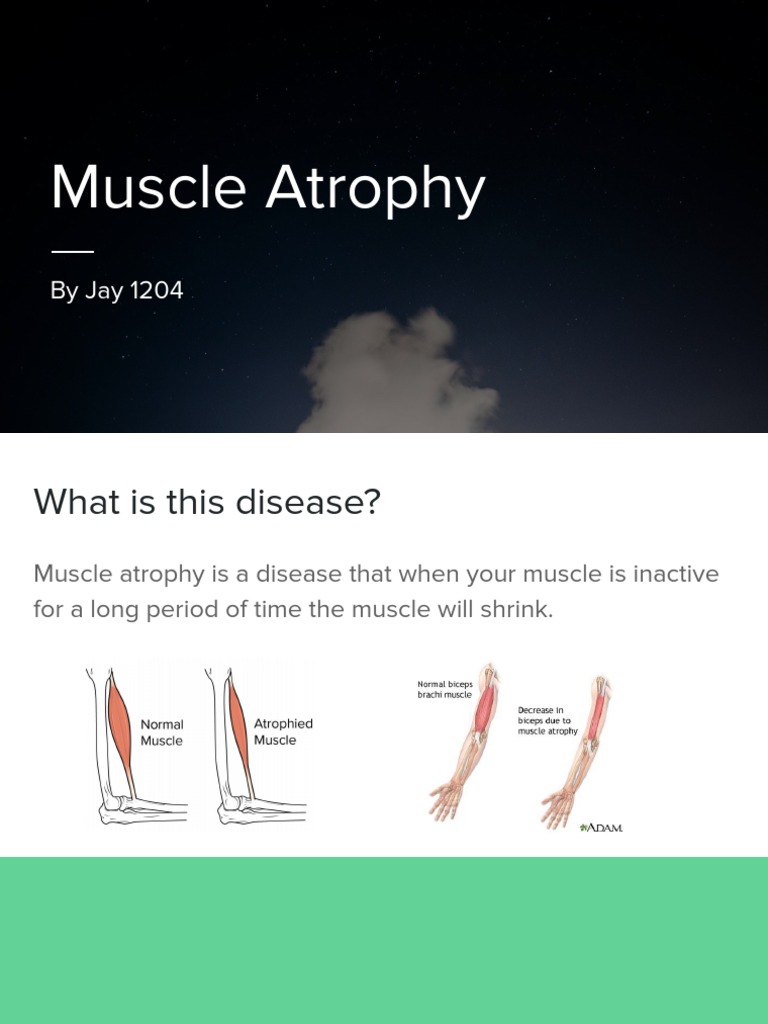 Muscle Atrophy | PDF | Wellness | Science & Mathematics
