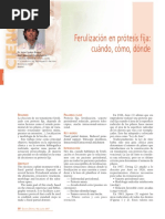 Efecto Ferula en Protesis Fija | PDF | Dentadura postiza | Boca