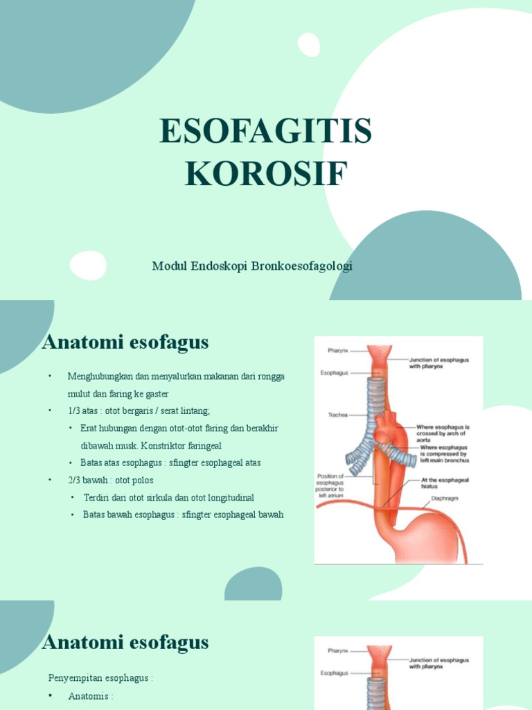 Esofagitis Korosif | PDF