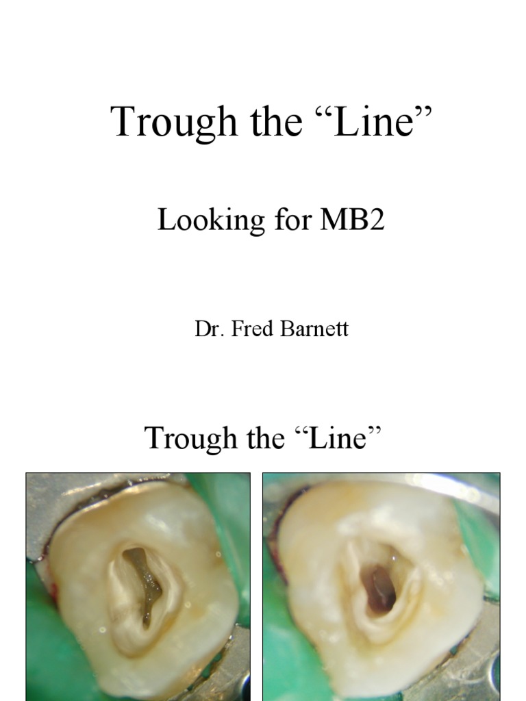 Troughing Techniques for MB2 Discovery | PDF | Home & Garden | Science ...