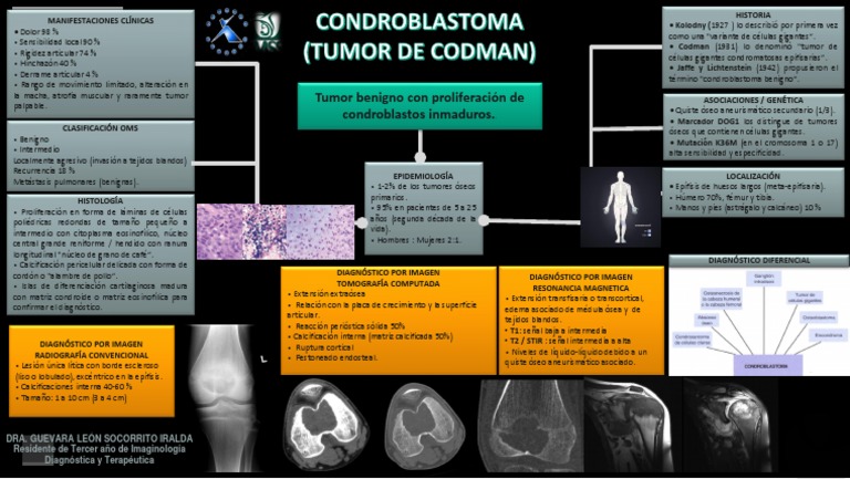 CONDROBLASTOMA | PDF | Neoplasias | Hueso