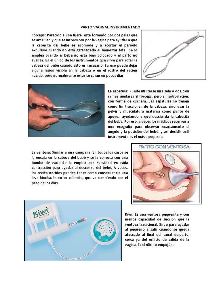 Parto Vaginal Instrumentado | PDF | Parto | Reproducción humana