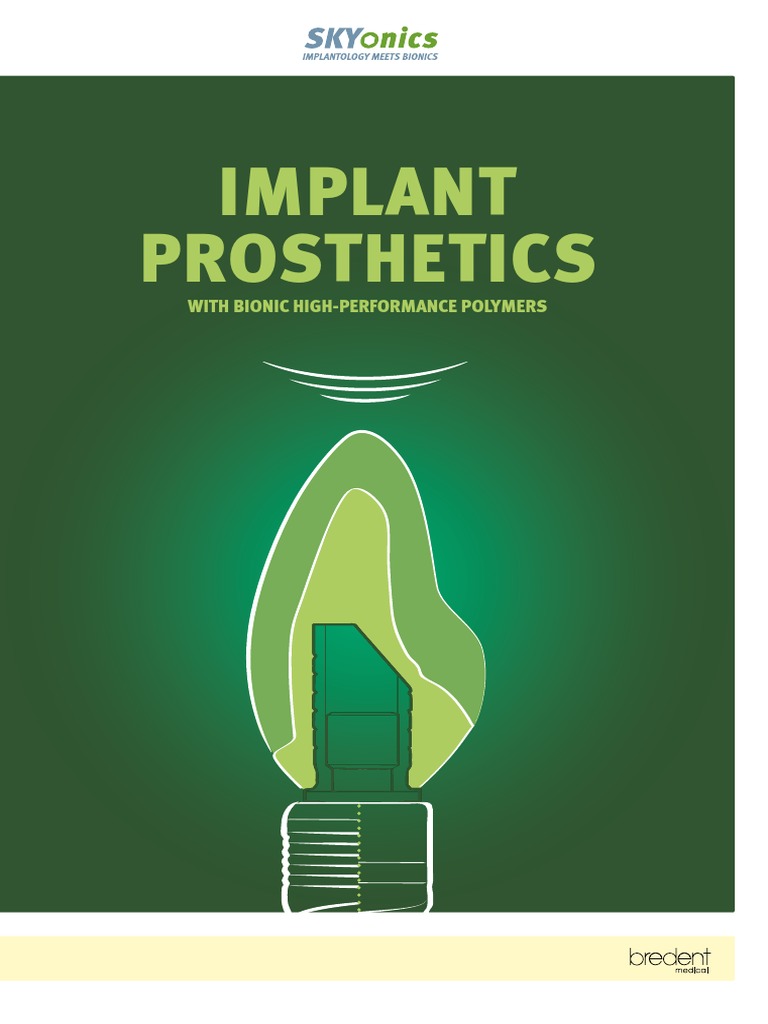 Implant Prosthetics: With Bionic High-Performance Polymers | PDF ...