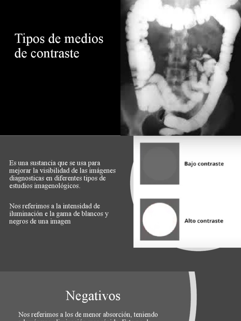 Tipos de Medios de Contraste en Radiología | PDF | Ion | Solubilidad