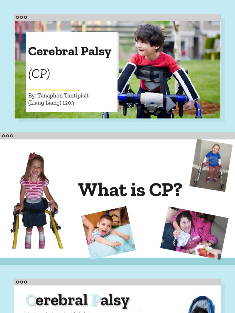 Cerebral Palsy | PDF | Cerebral Palsy | Human Diseases And Disorders