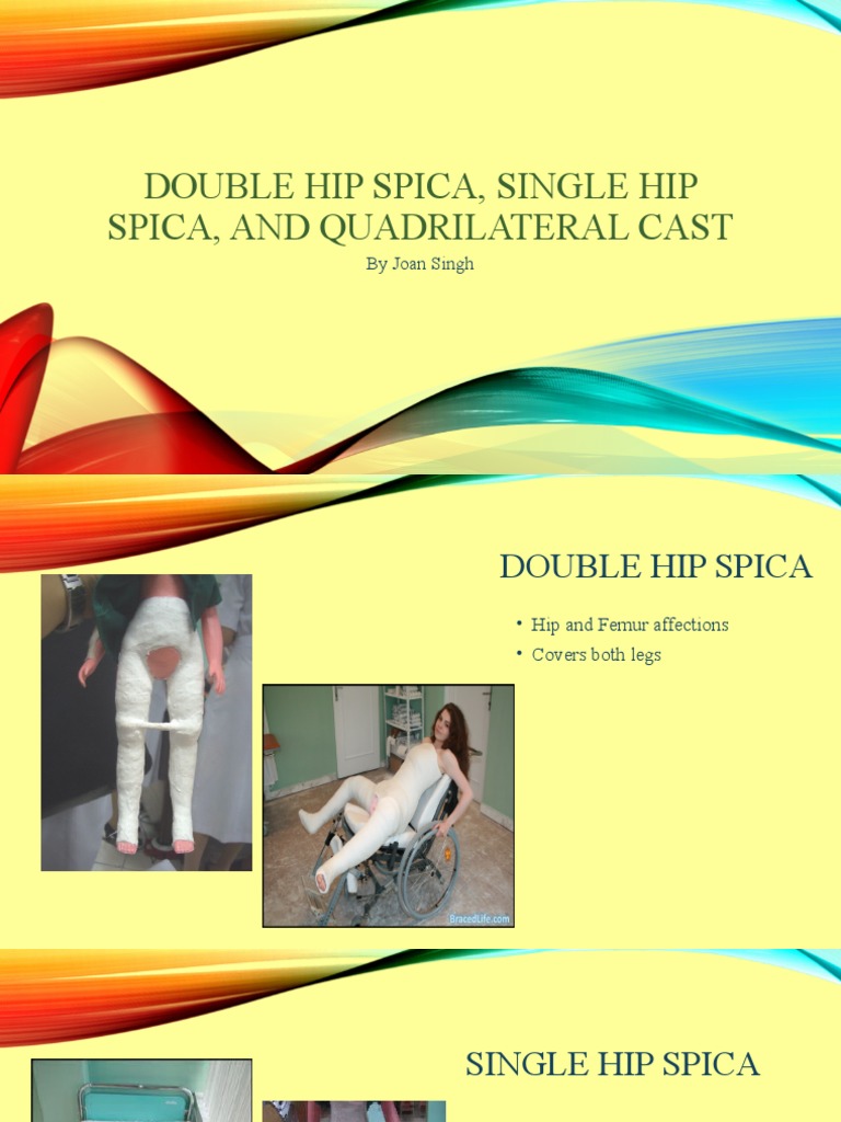 Types of Hip Spica and Quadrilateral Casts | PDF | Social Science