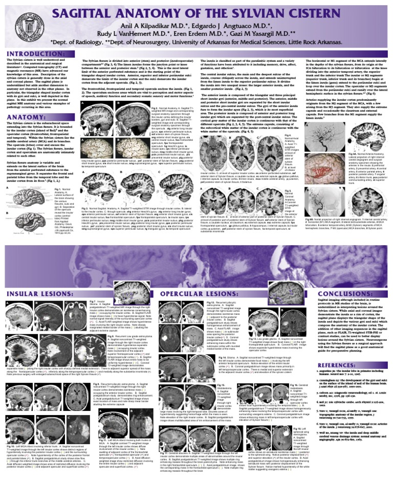 Sylvian Cistern PDF | PDF | Insular Cortex | Cerebral Cortex