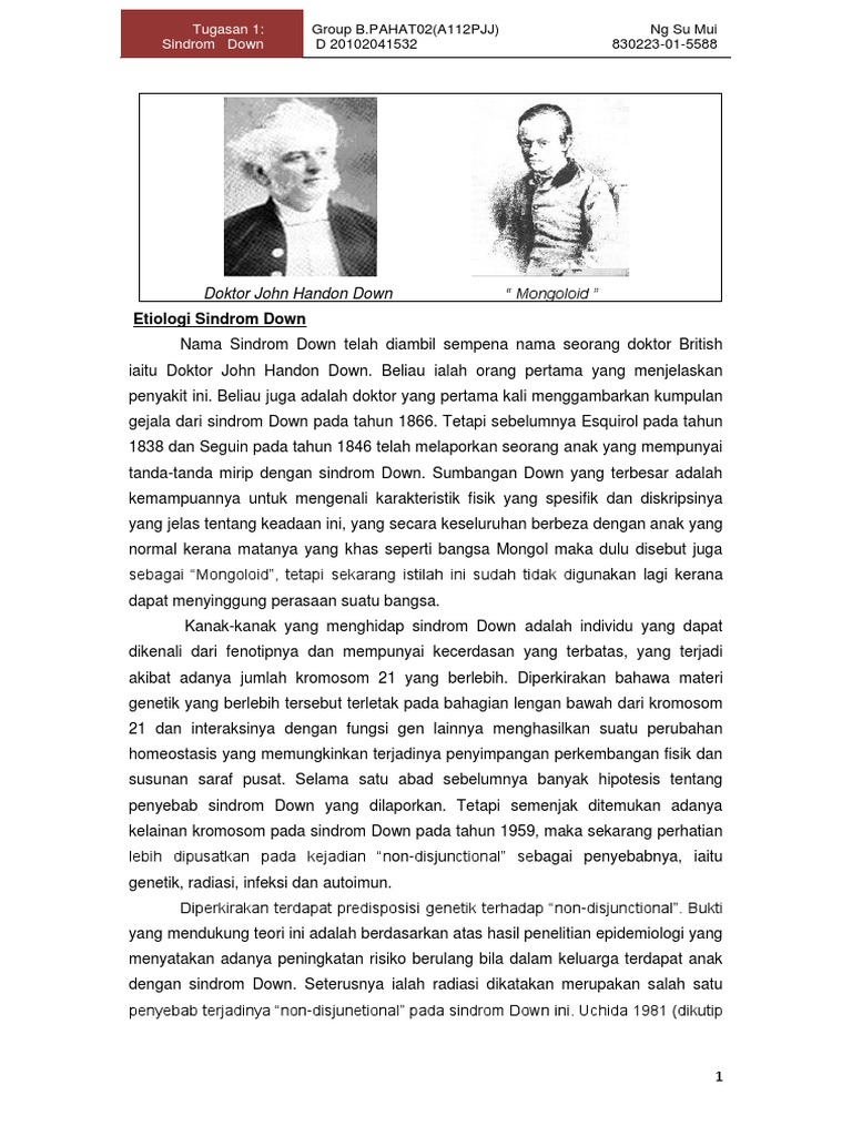 Sindrom Down PDF | PDF