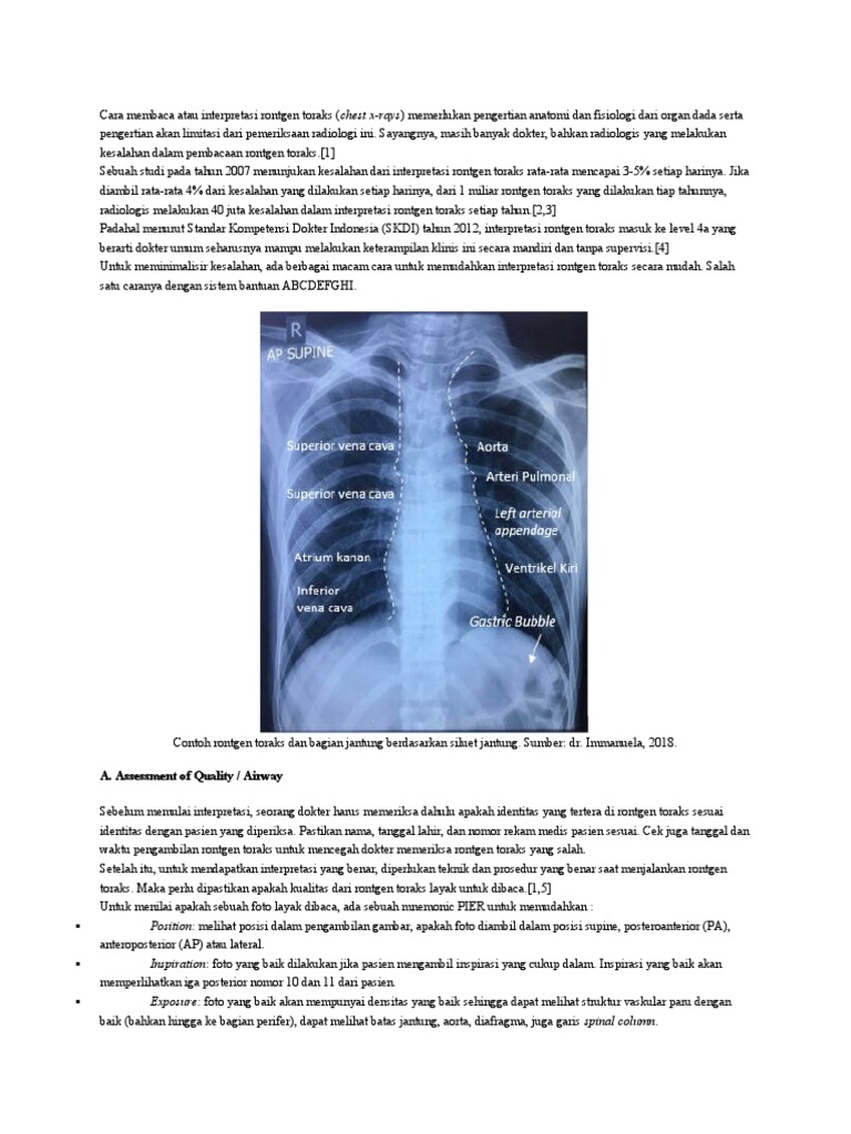 Cara Membaca Rontgen Toraks Menggunakan Sistem ABCDEFGHI | PDF